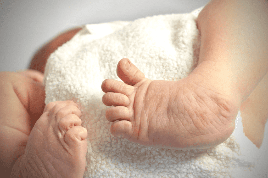 Clubfoot correction in Children - Can It be Easily Corrected?